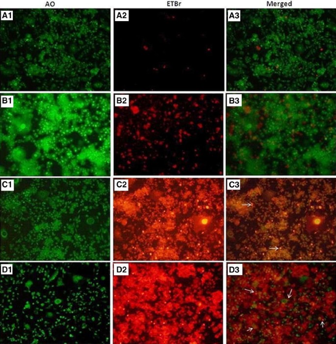 Characterization and anticancer potential of ferulic acid-loaded ...