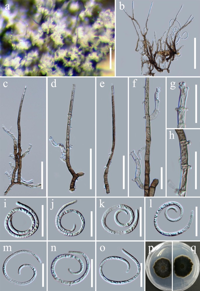 A taxonomic reassessment of Tubeufiales based on multi-locus phylogeny ...
