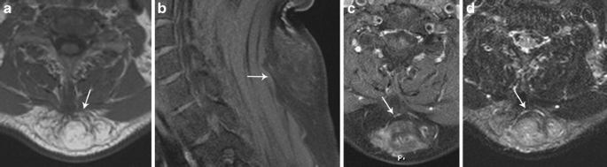 A comparison between histopathology and findings on magnetic resonance ...