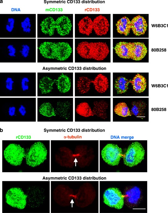 Distribution of CD133 reveals glioma stem cells self-renew through ...