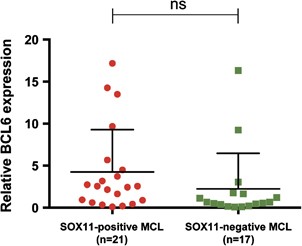 SOX11 defines two different subtypes of mantle cell lymphoma through ...