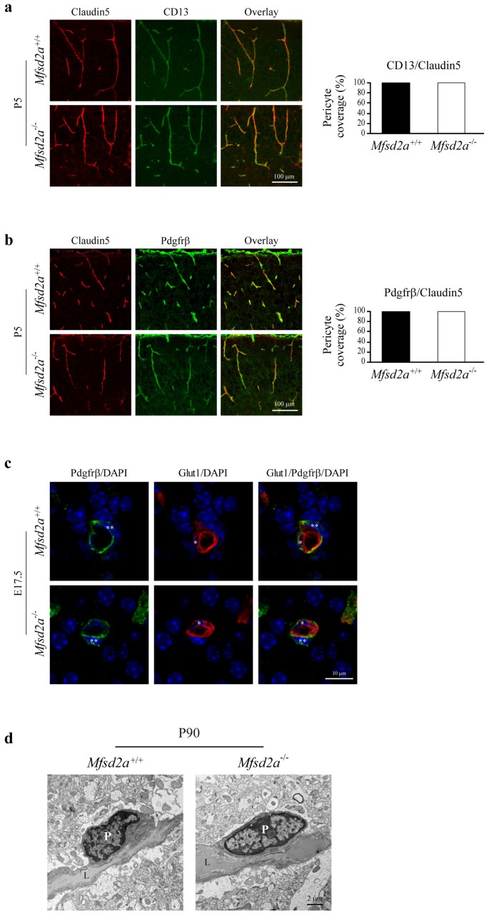 Mfsd2a is critical for the formation and function of the blood–brain ...