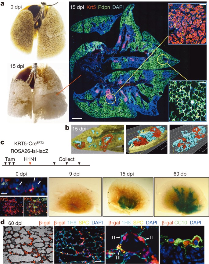 p63 + Krt5 + distal airway stem cells are essential for lung ...