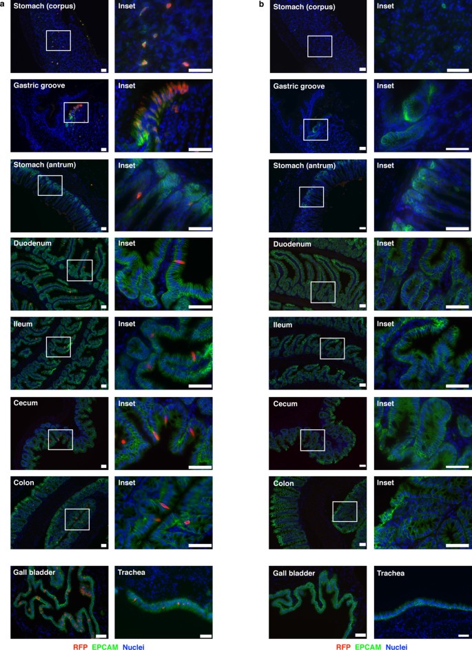 Tuft-cell-derived IL-25 regulates an intestinal ILC2–epithelial ...