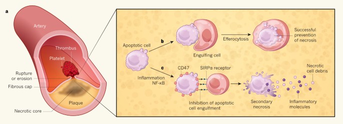 Death-defying plaque cells | Nature
