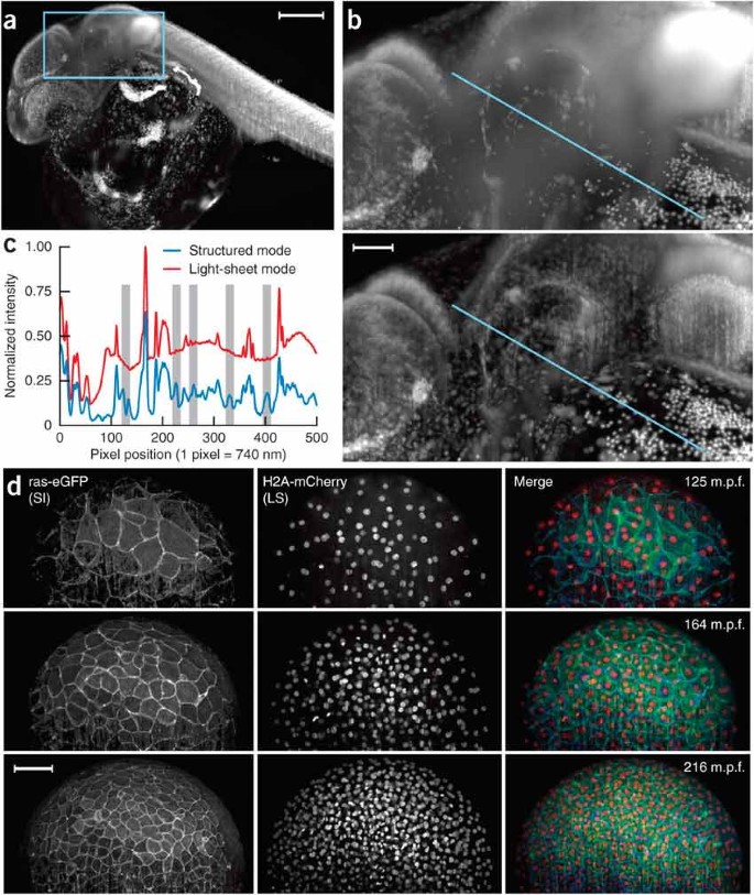 Fast, high-contrast imaging of animal development with scanned light ...