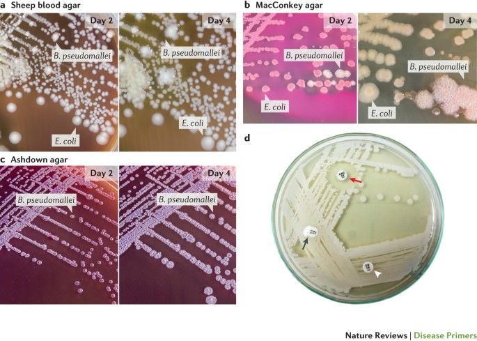 Melioidosis | Nature Reviews Disease Primers
