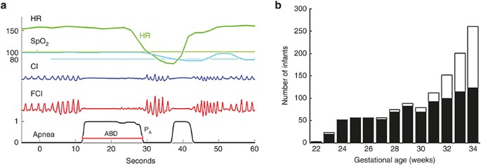 Clinical associations of immature breathing in preterm infants: part 1 ...