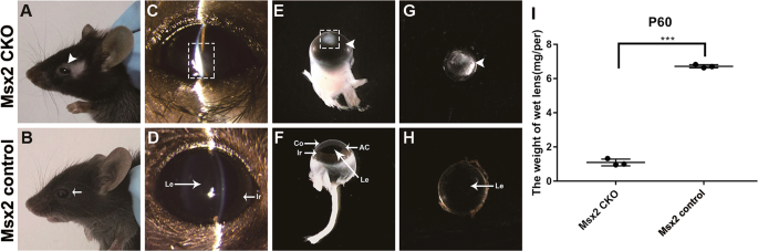 Lens-specific conditional knockout of Msx2 in mice leads to ocular ...