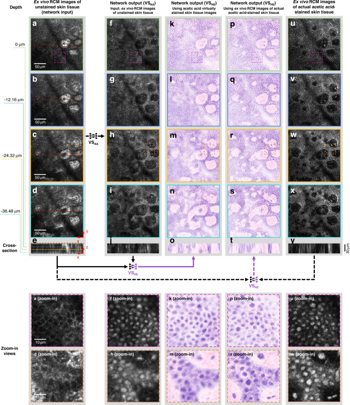 Biopsy-free in vivo virtual histology of skin using deep learning ...