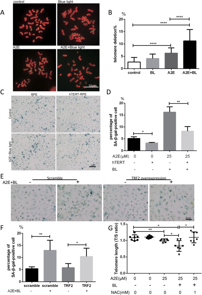 Photosensitization of A2E triggers telomere dysfunction and accelerates ...