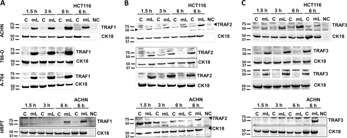 CD40 induces renal cell carcinoma-specific differential regulation of ...