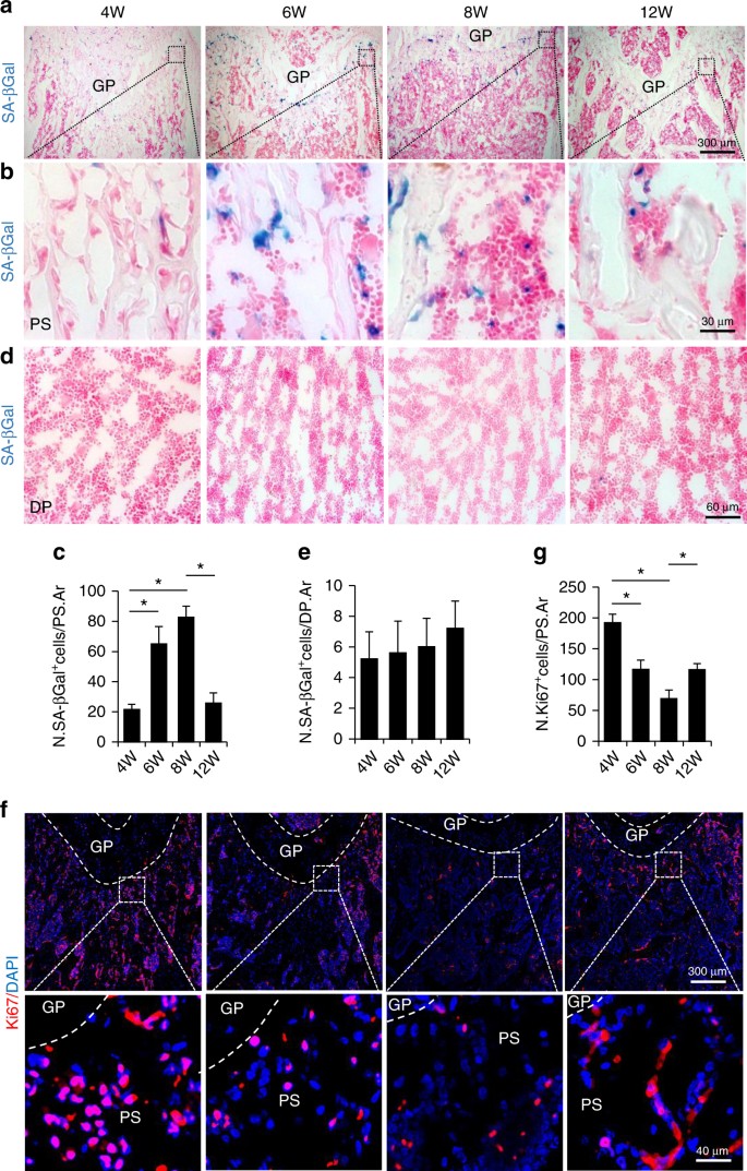 Programmed cell senescence in skeleton during late puberty | Nature ...