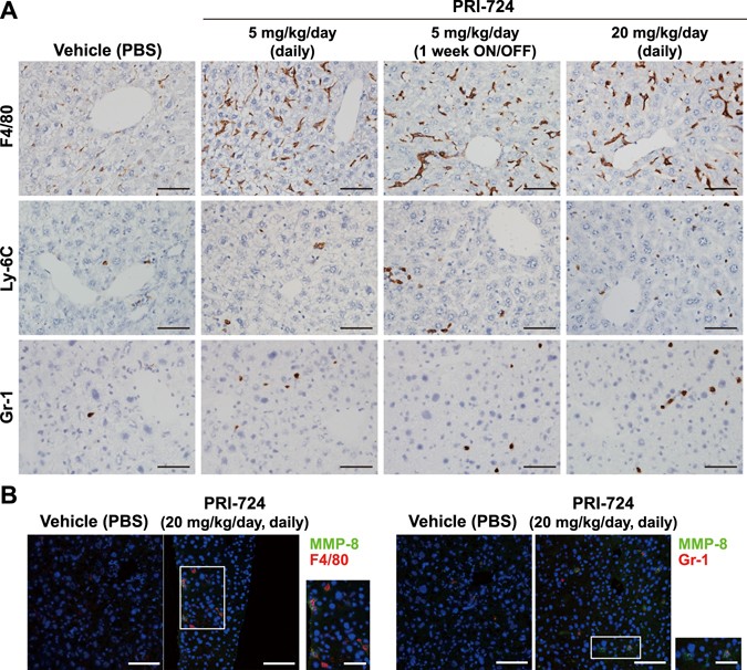 Selective inhibitor of Wnt/β-catenin/CBP signaling ameliorates ...