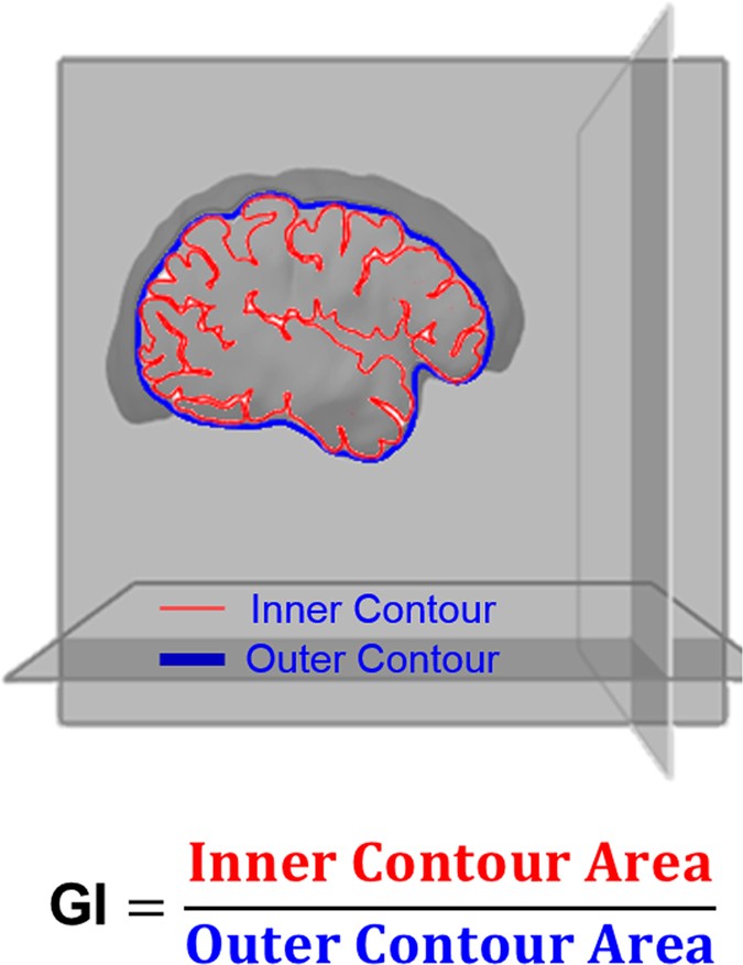 Lifespan Gyrification Trajectories of Human Brain in Healthy ...