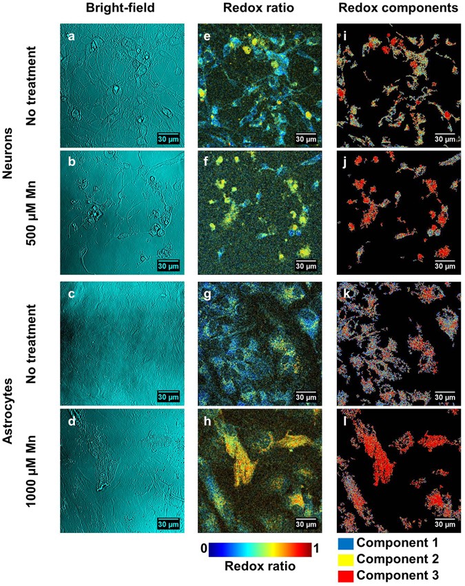 Endogenous Two-Photon Excited Fluorescence Imaging Characterizes Neuron ...