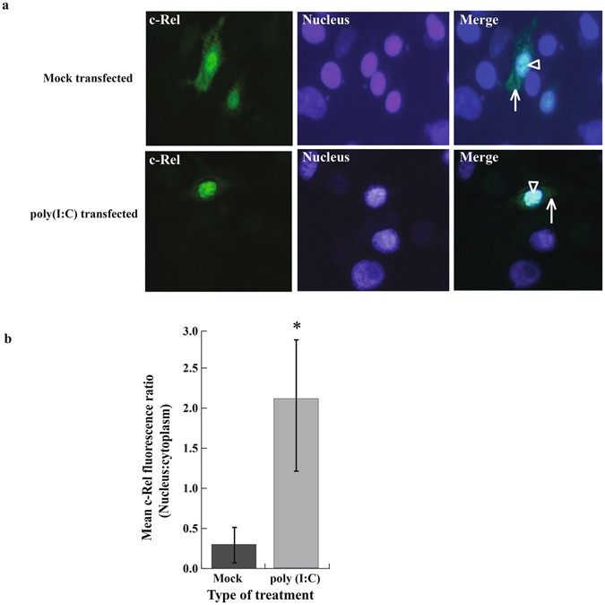 Lack of inflammatory gene expression in bats: a unique role for a ...