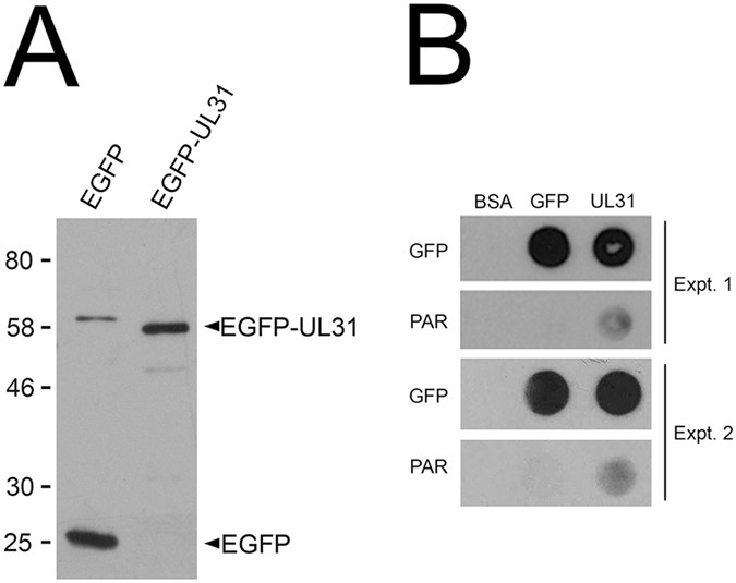 The Herpesvirus Nuclear Egress Complex Component, UL31, Can Be ...