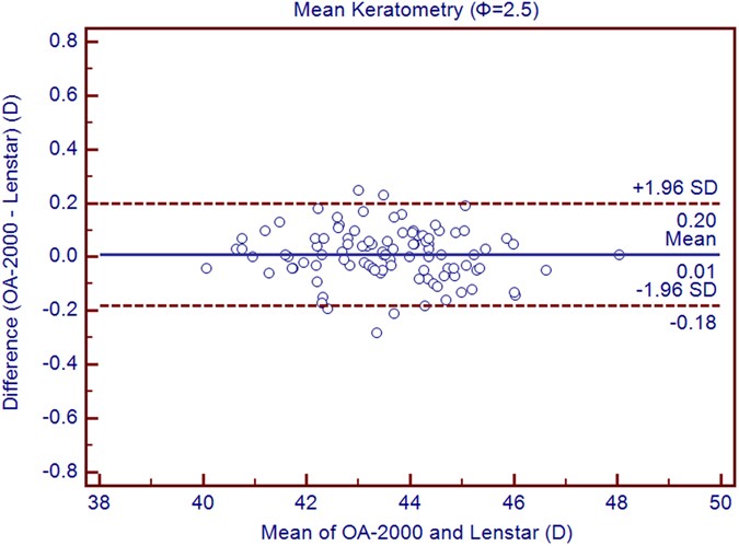 Comparison of ocular biometric measurements between a new swept-source ...