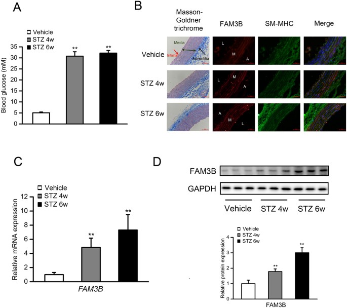 FAM3B mediates high glucose-induced vascular smooth muscle cell ...