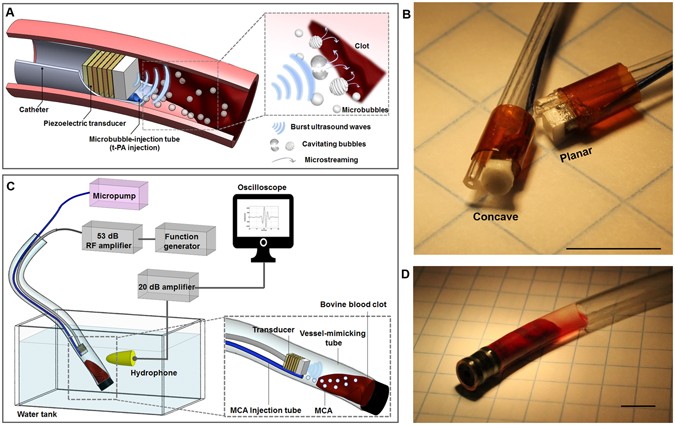 Intravascular forward-looking ultrasound transducers for microbubble ...