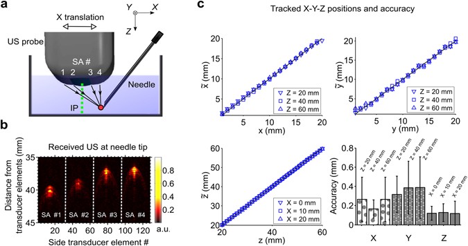 Looking beyond the imaging plane: 3D needle tracking with a linear ...