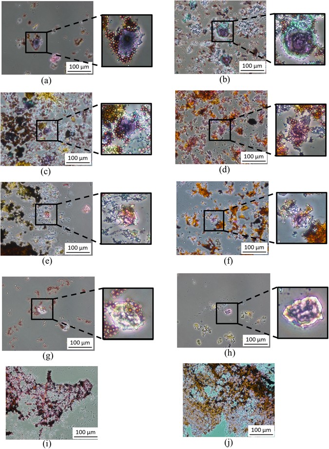 A Microfluidic Chip for Detecting Cholangiocarcinoma Cells in Human ...
