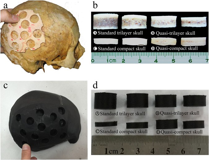 A novel 3D-printed head phantom with anatomically realistic geometry ...