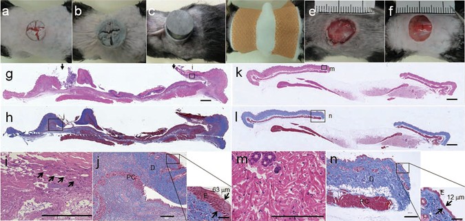 Development of Novel Mouse Model of Ulcers Induced by Implantation of ...