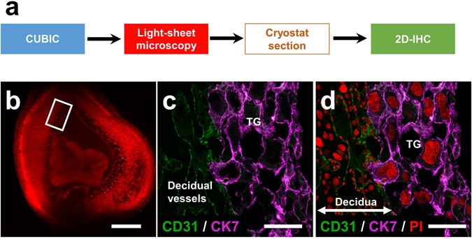 Three-dimensional visualization of intrauterine conceptus through the ...