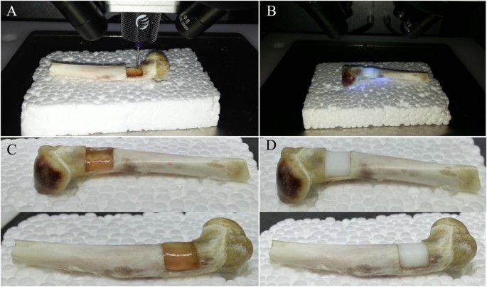 In situ repair of bone and cartilage defects using 3D scanning and 3D ...