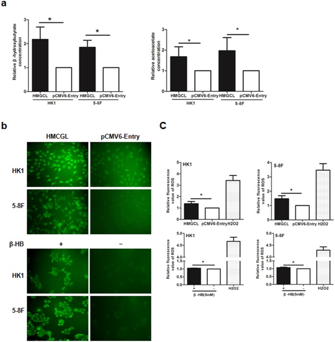 Inactivation of HMGCL promotes proliferation and metastasis of ...