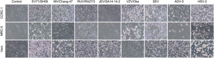 The hUC-MSCs cell line CCRC-1 represents a novel, safe and high ...