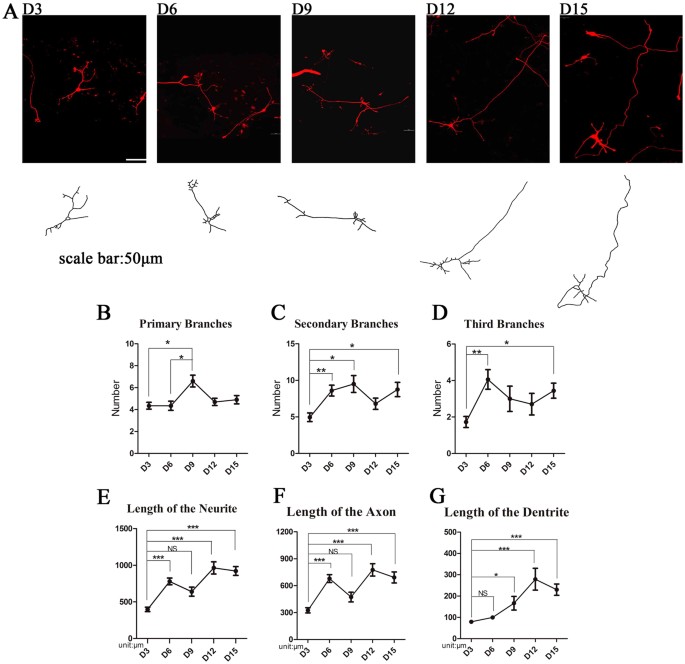 Characteristic analyses of a neural differentiation model from iPSC ...