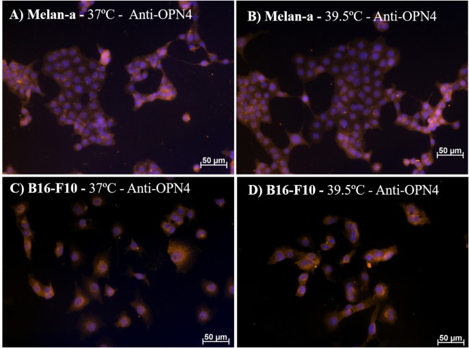Melanopsin, a Canonical Light Receptor, Mediates Thermal Activation of ...