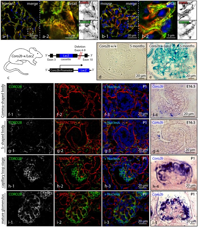 The WD40-domain containing protein CORO2B is specifically enriched in ...