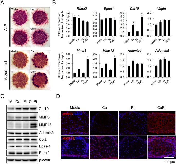 Calcium-phosphate complex increased during subchondral bone remodeling ...