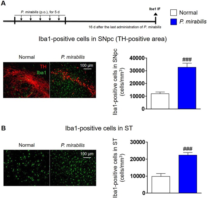 Oral administration of Proteus mirabilis damages dopaminergic neurons ...