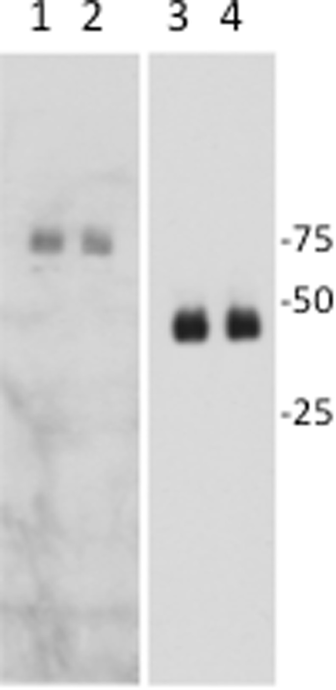 A novel mouse model carrying a human cytoplasmic dynein mutation shows ...