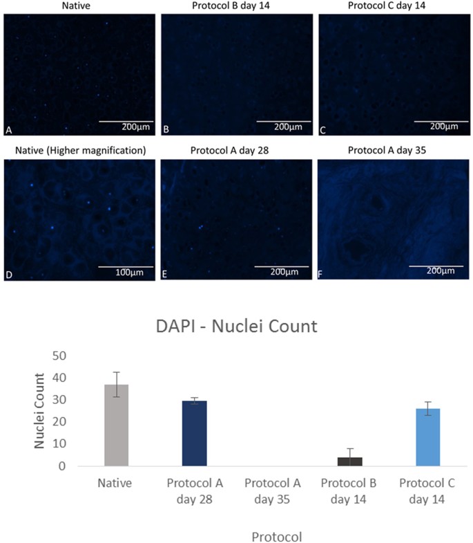 Optimising the decellularization of human elastic cartilage with ...