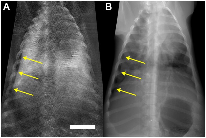 Depiction of pneumothoraces in a large animal model using x-ray dark ...