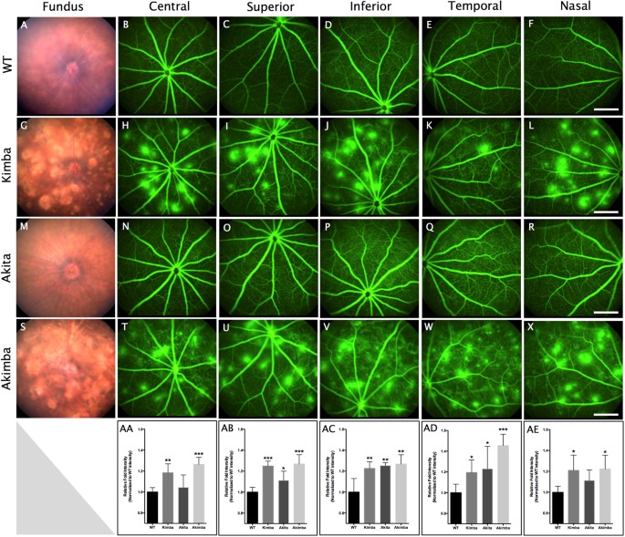 The NLRP3 Inflammasome May Contribute to Pathologic Neovascularization ...