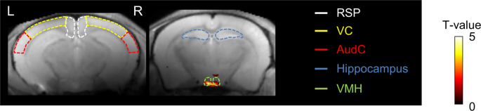 The impact of fasting on resting state brain networks in mice ...