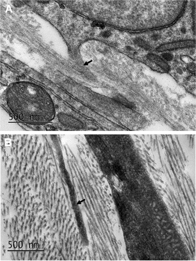 Three-dimensional imaging of the extracellular matrix and cell ...