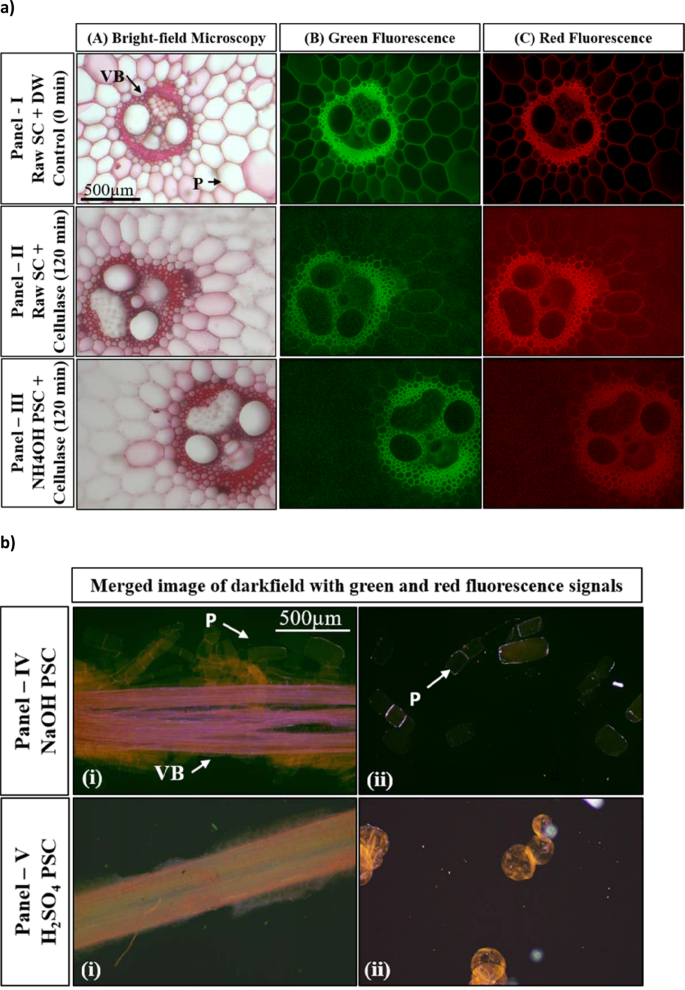 Valorization of sugarcane bagasse by chemical pretreatment and enzyme mediated deconstruction ...