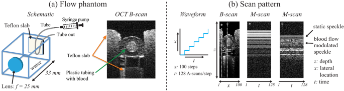 A Neural Network Approach to Quantify Blood Flow from Retinal OCT ...