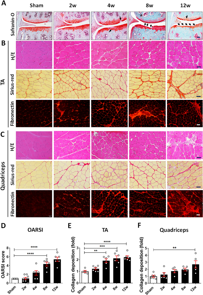 A causative role for periarticular skeletal muscle weakness in the ...