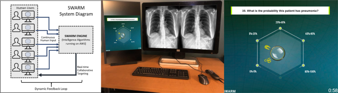 Human–machine partnership with artificial intelligence for chest ...