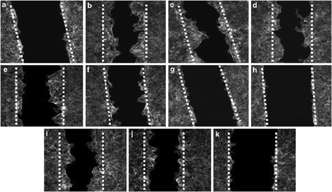 The green tea catechins, (−)-Epigallocatechin-3-gallate (EGCG) and (− ...