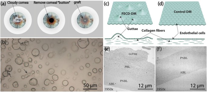 The Ultrastructures and Mechanical Properties of the Descement’s ...